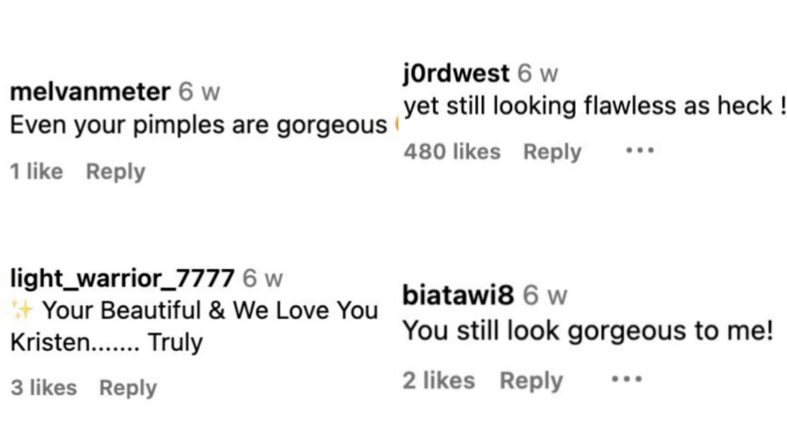 kristen bell face looks weird | kristen bell facework | kristen bell ...