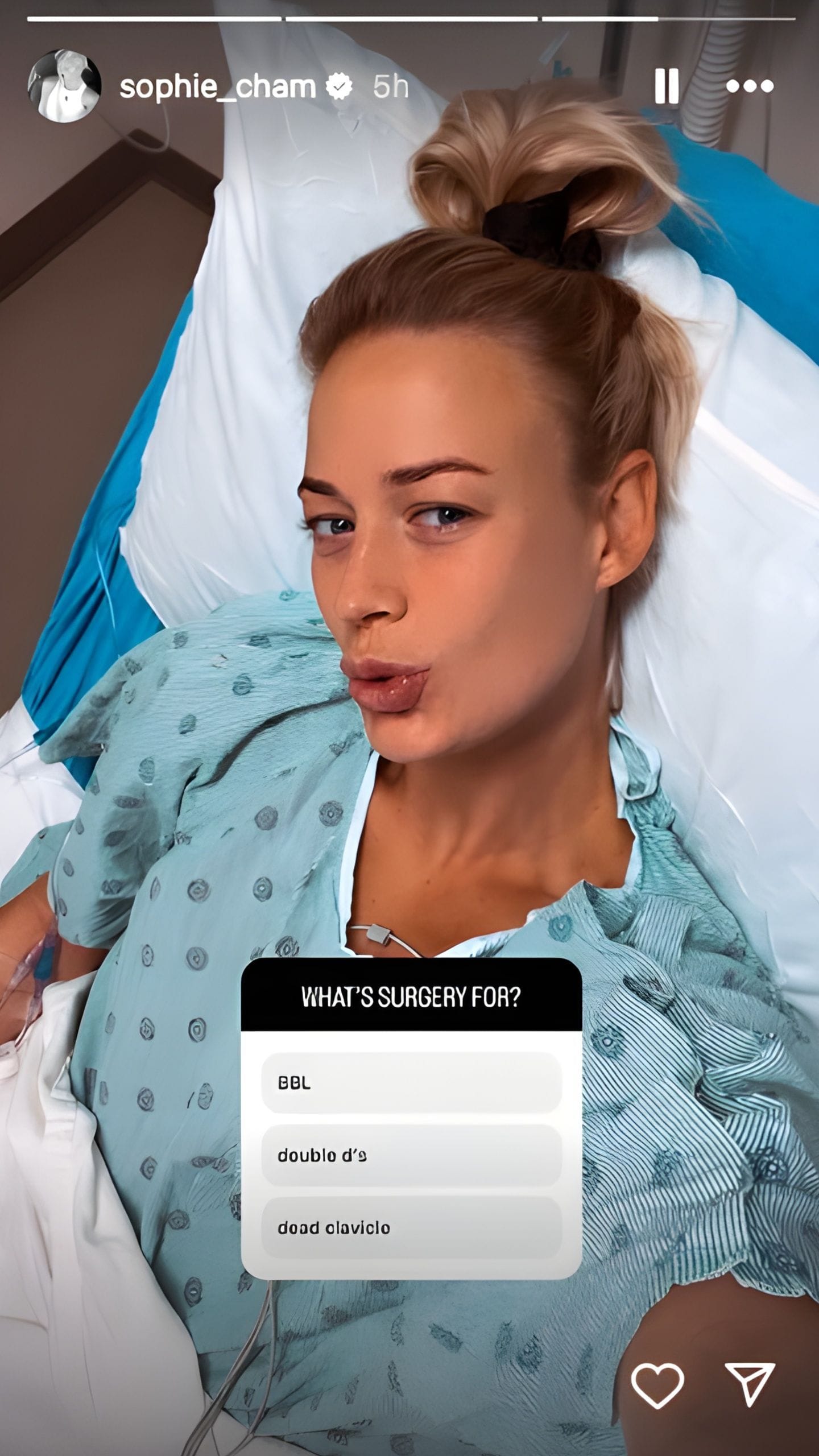 "BBL or Double Ds?": Sophie Cunningham poses cheeky surgery question ...