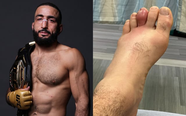 Belal Muhammad reveals he considered amputating infected toe to fight ...