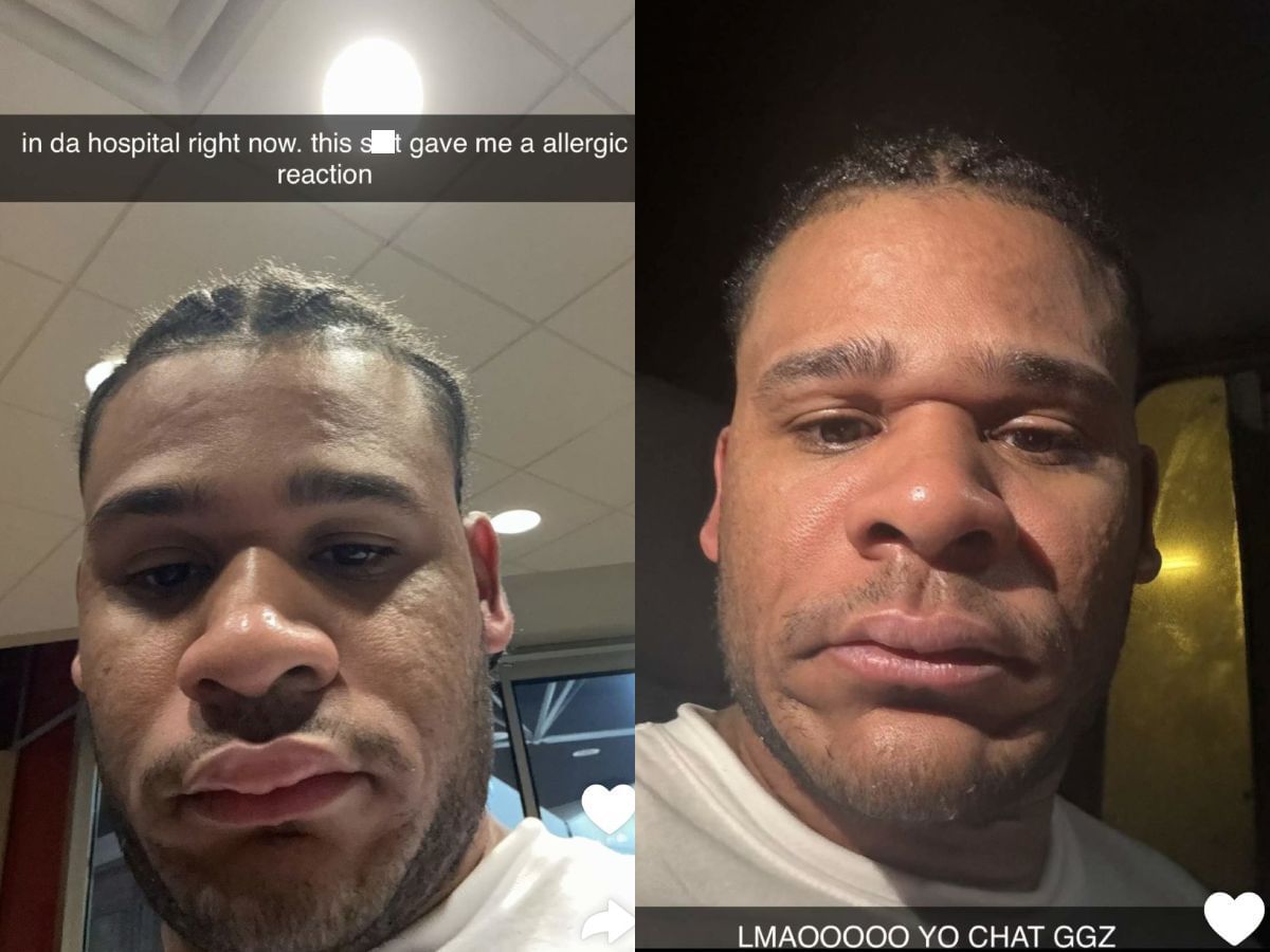 What happened to Fanum? Streamer sparks concern after suffering ...