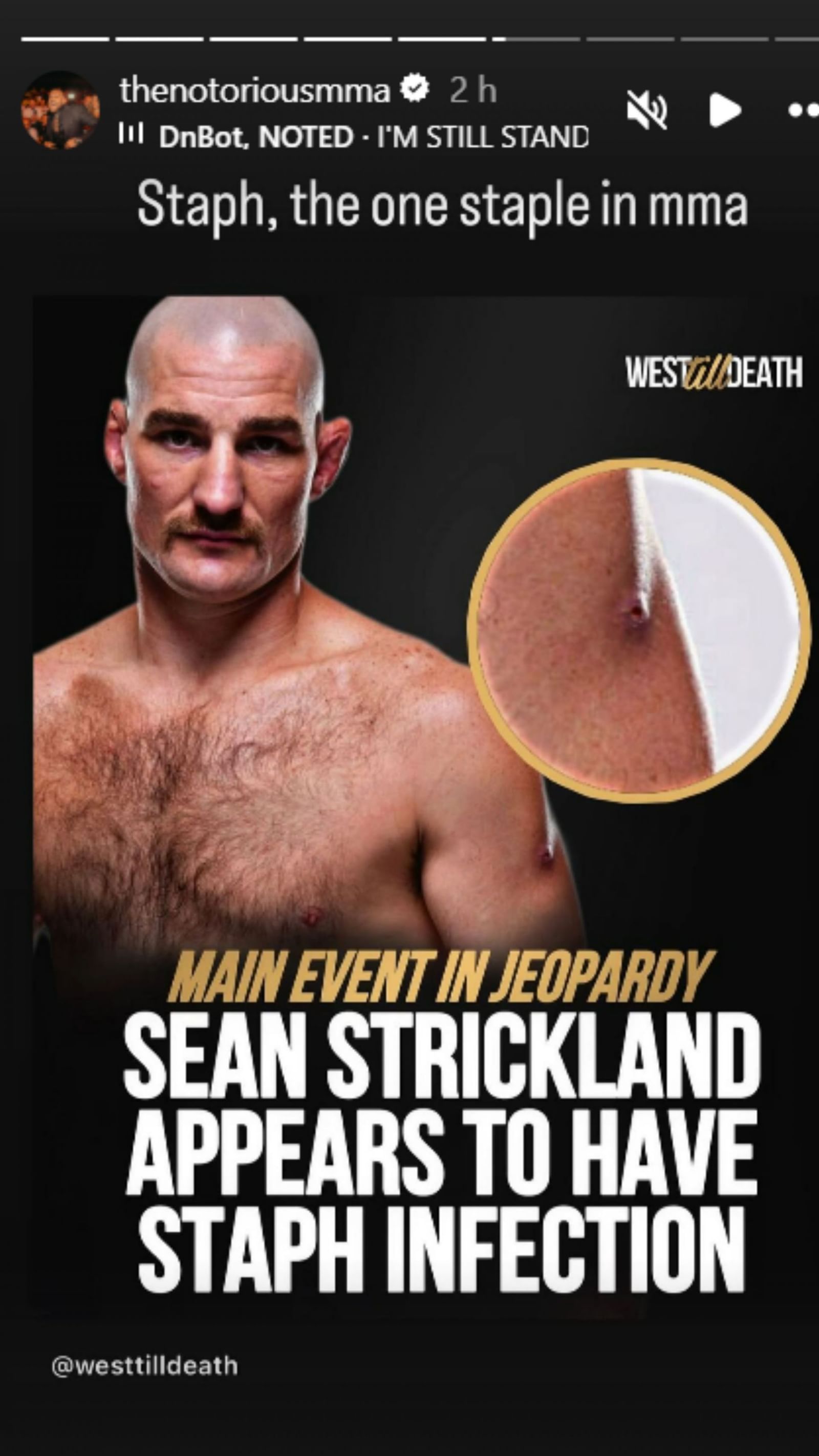 Sean Strickland: Conor McGregor shares six-word reaction to staph ...