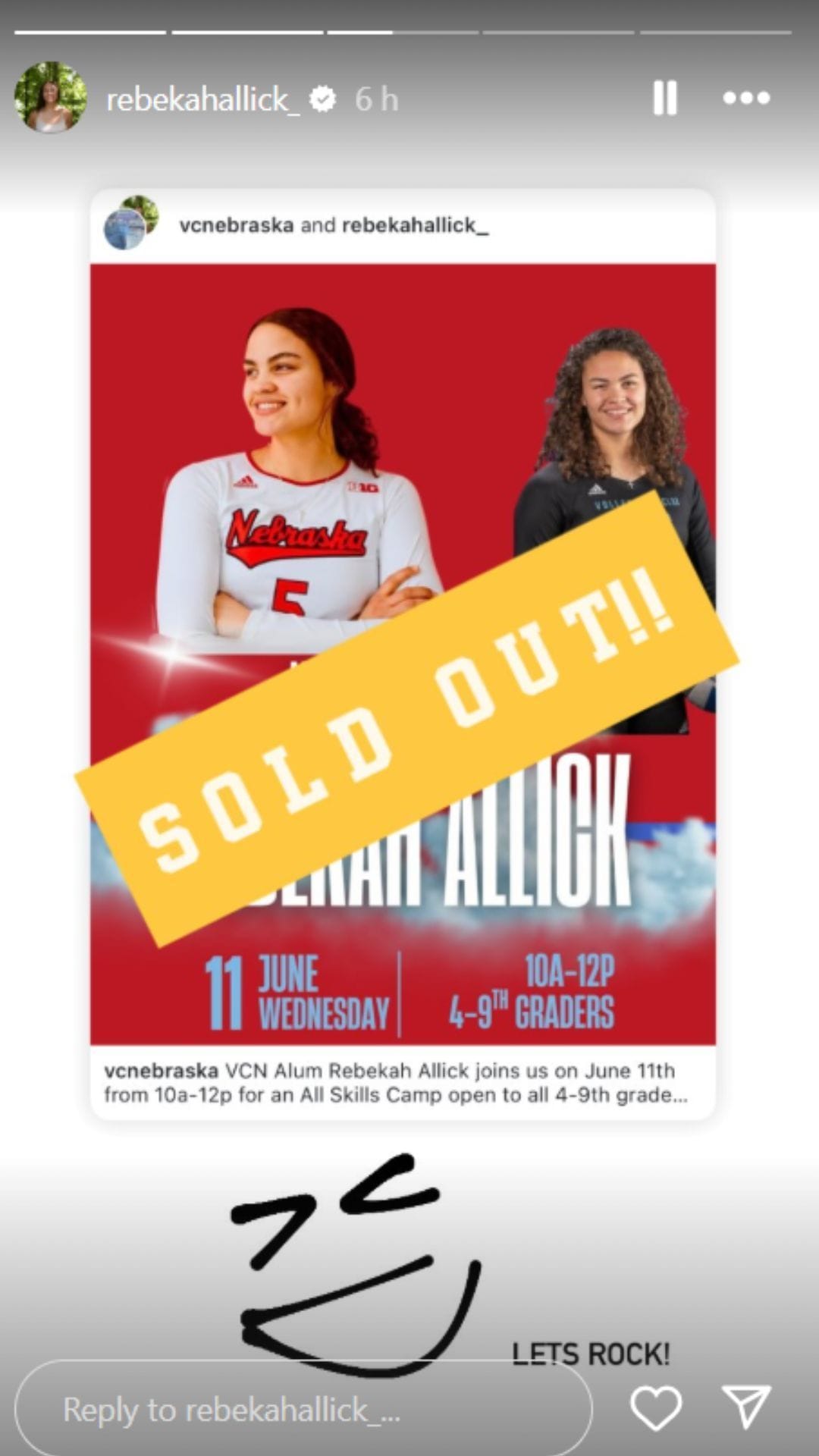 Nebraska Volleyball's Rebekah Allick reacts as her camp receives a ...