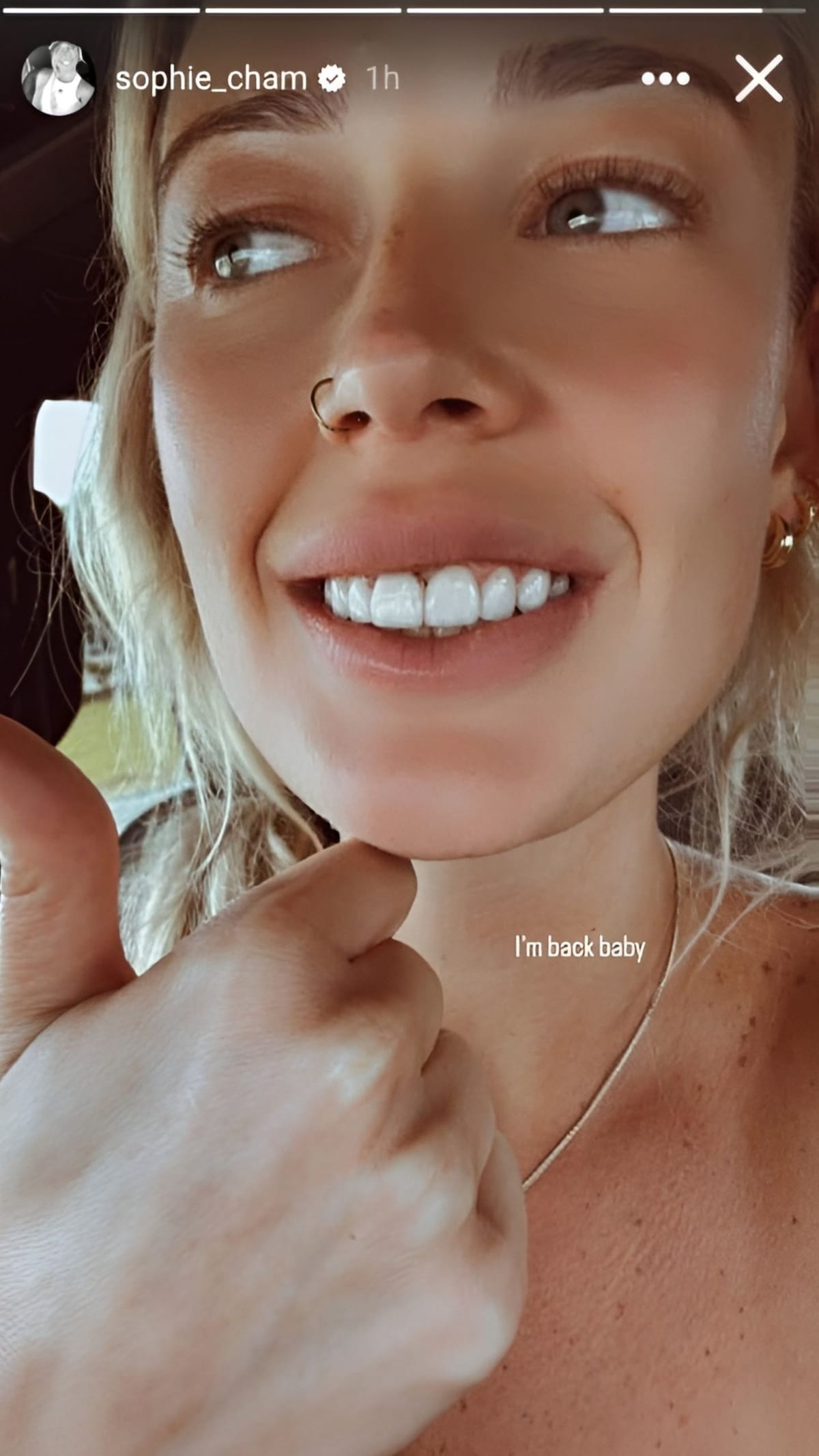 Caitlin Clark hilariously trolls Sophie Cunningham's chipped tooth ...