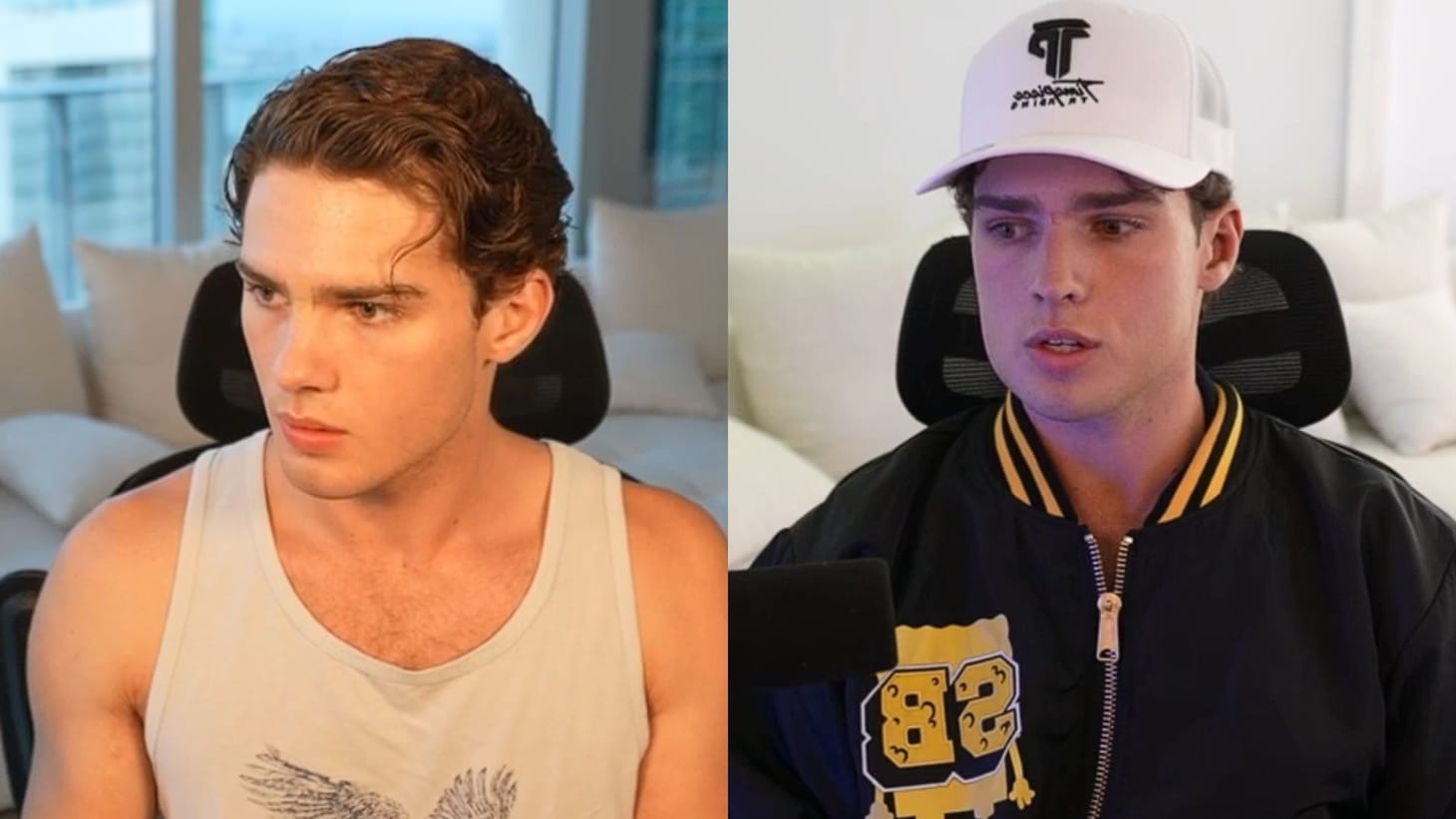 Clavicular before and after his nose surgery